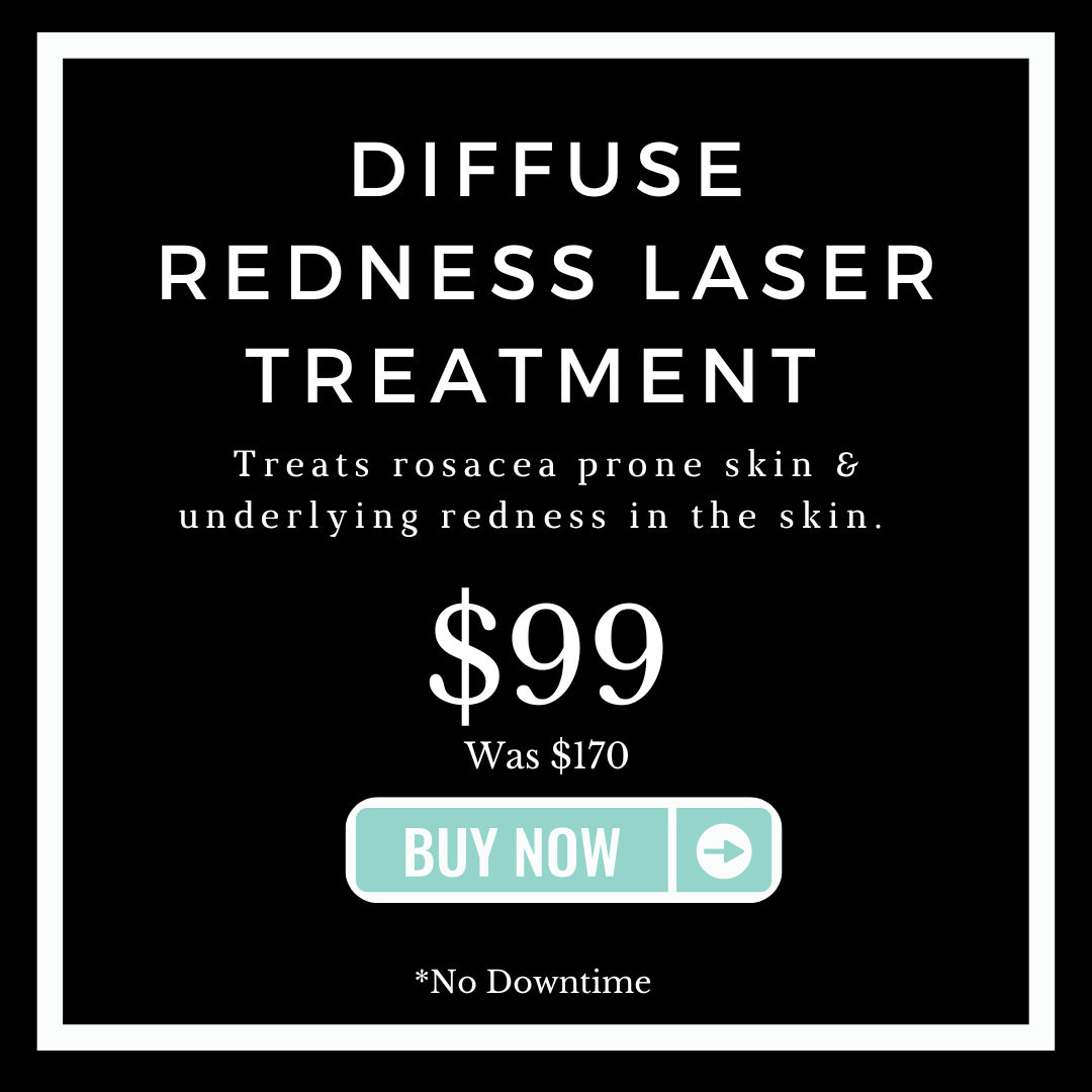 Skin Clinic South Brisbane - Skin Clinic West End | Skin Clique